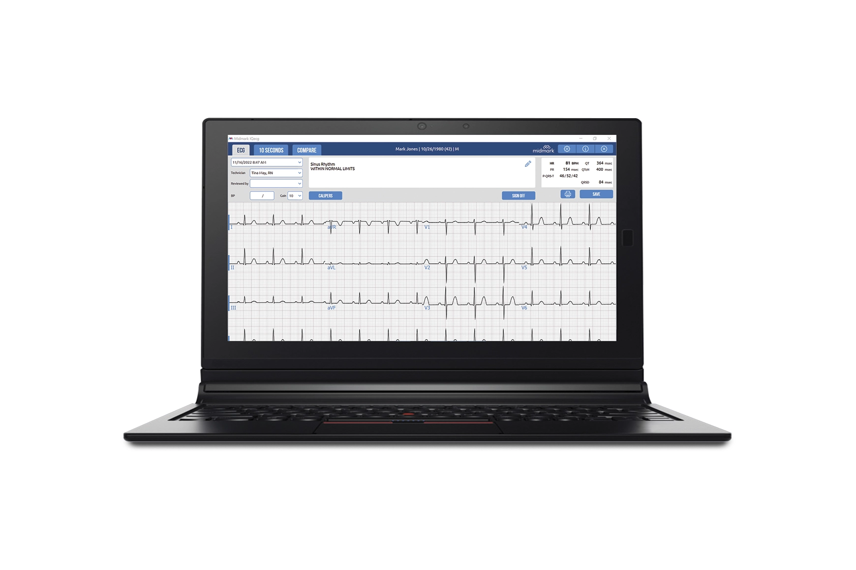 Midmark® Digital ECG